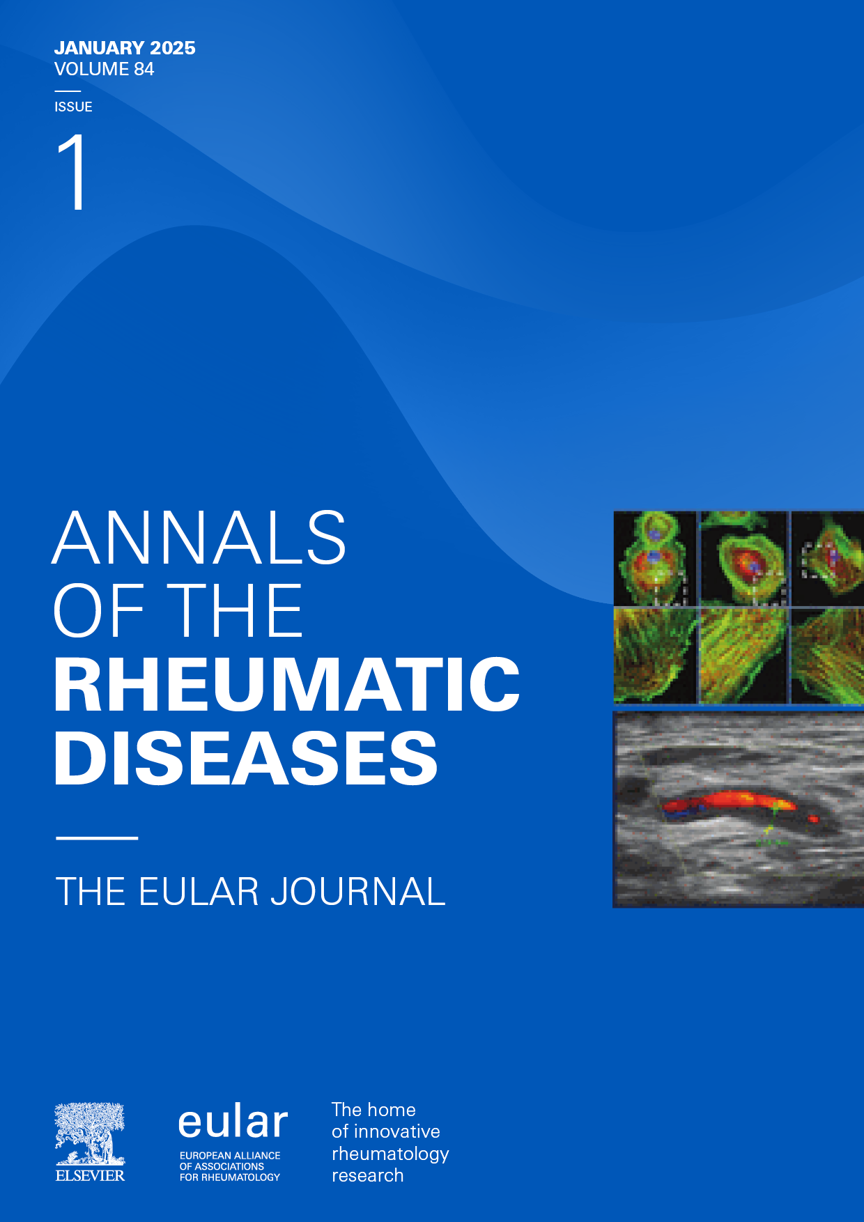 EULAR Journals | EULAR